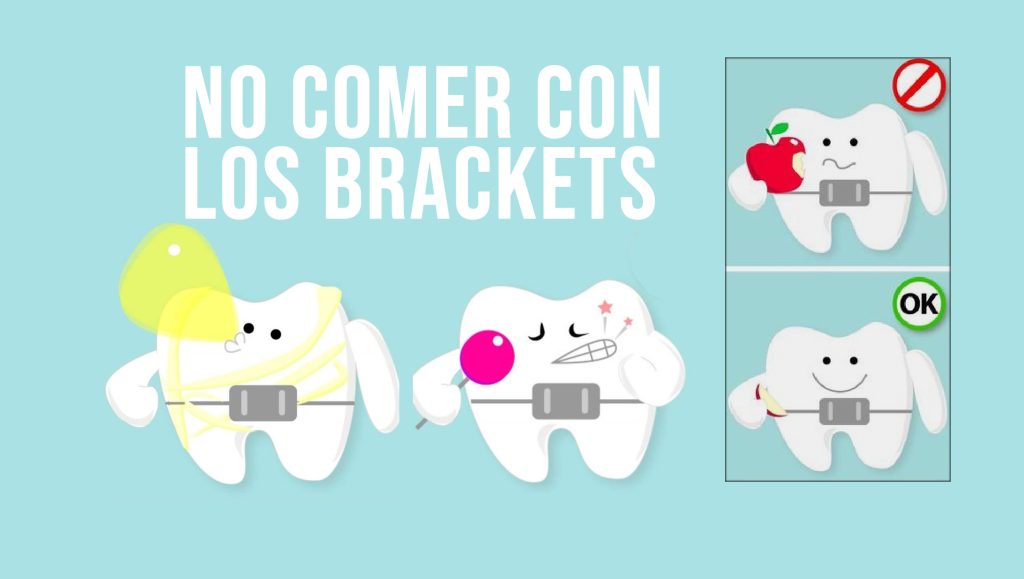 Alimentos Prohibidos cuando llevas BRACKETS – HN Ortodoncia