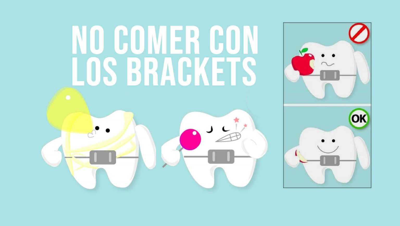 Alimentos Prohibidos cuando llevas BRACKETS – HN Ortodoncia