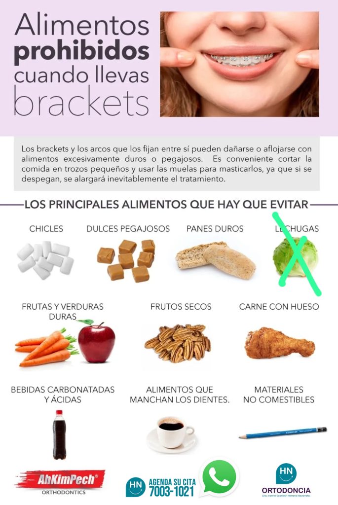 Alimentos Prohibidos cuando llevas BRACKETS – HN Ortodoncia